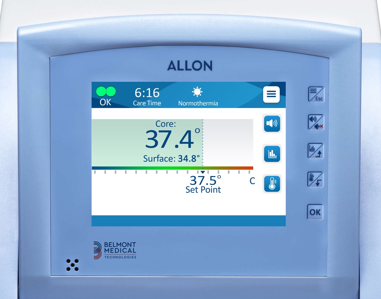 Allon: Perioperative Warming - Patient Warming Devices | Belmont Medical
